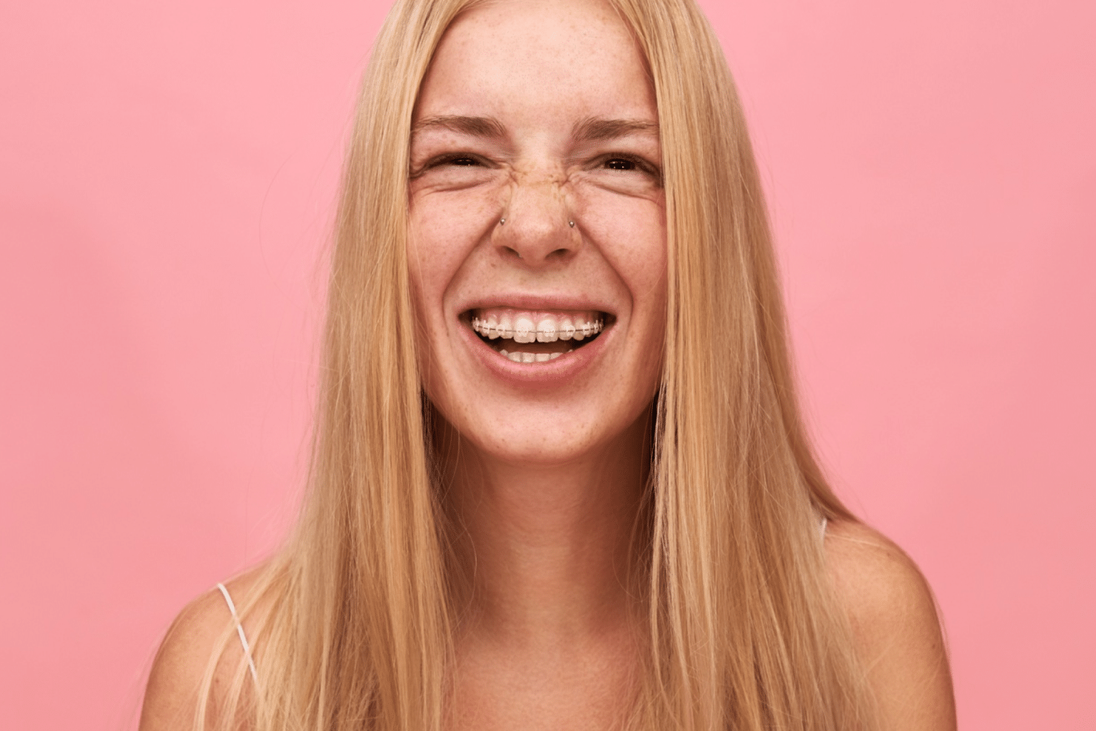 Best Invisible Braces & Clear Aligners in Kerala | Whitestone